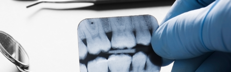 Dental Negligence Claims | Patient Claim Line